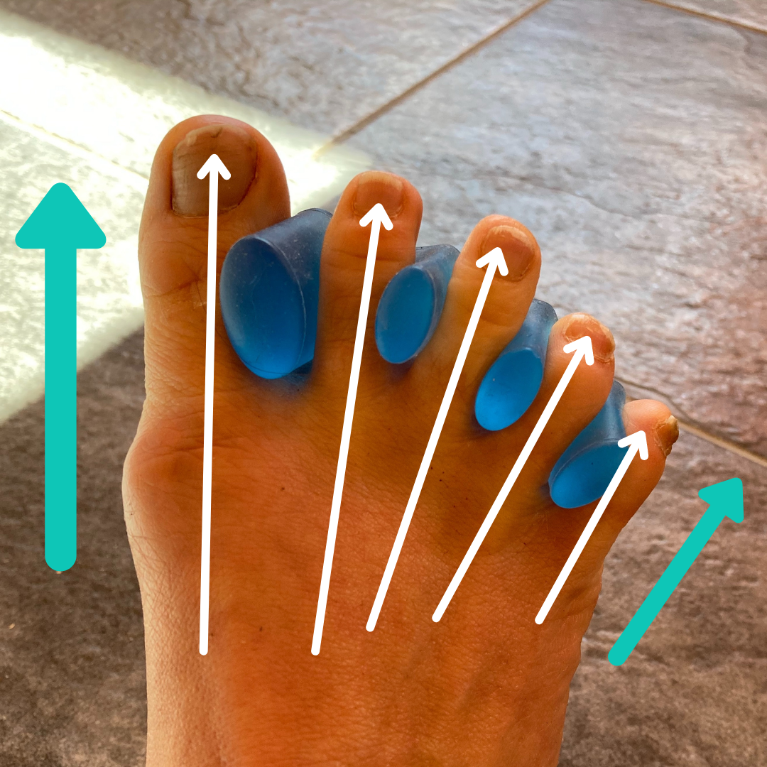Toe Spacers: Game-changing Hack or Gimmick? - Bare Soled Girl